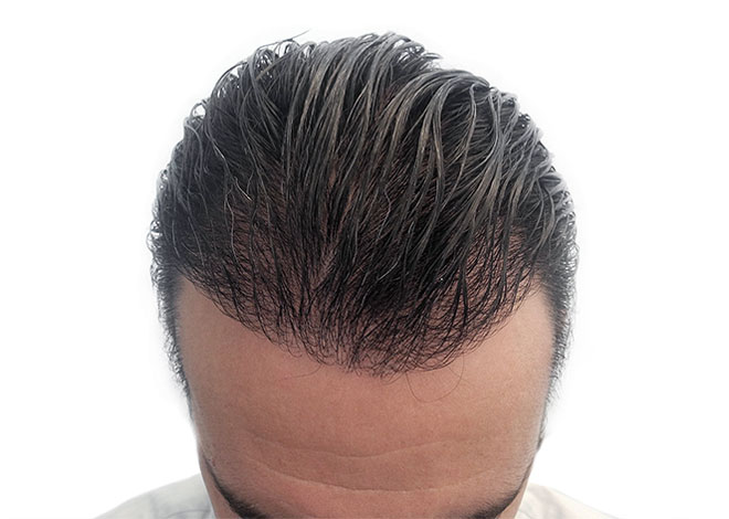 Before & After Photos | Dr. Shim Ching