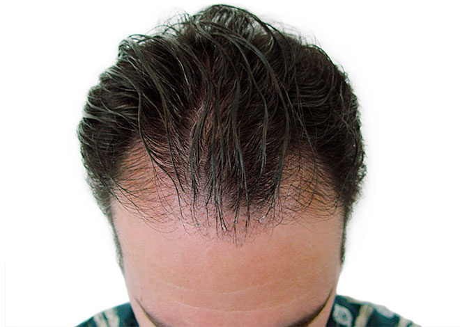 Before & After Photos | Dr. Shim Ching