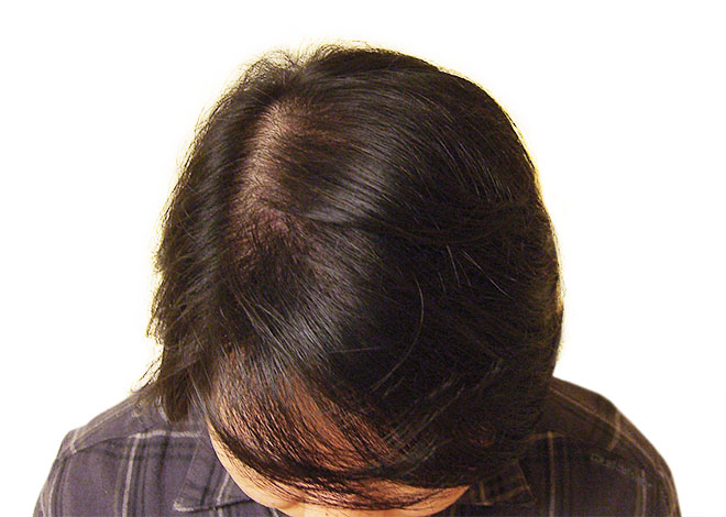 Before & After Photos | Dr. Shim Ching