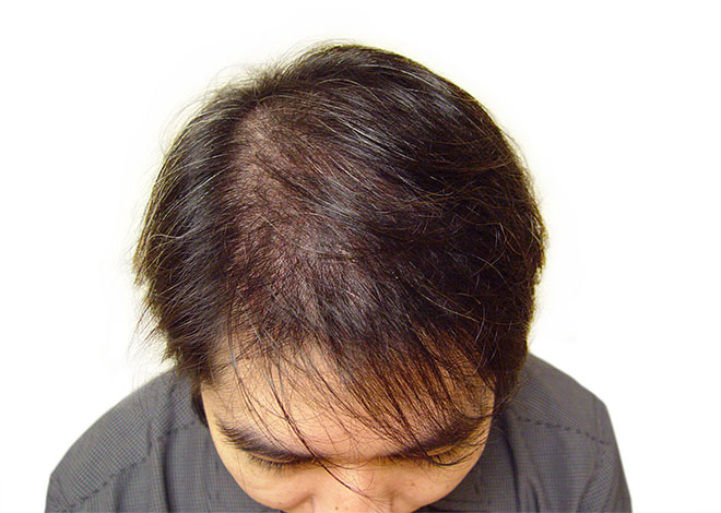 Before & After Photos | Dr. Shim Ching