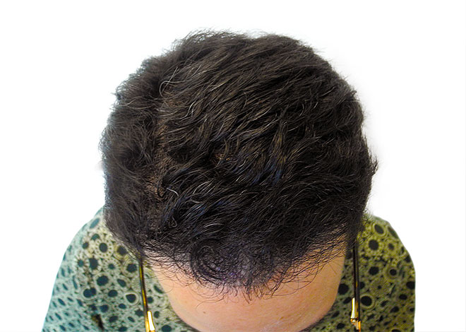 Before & After Photos | Dr. Shim Ching