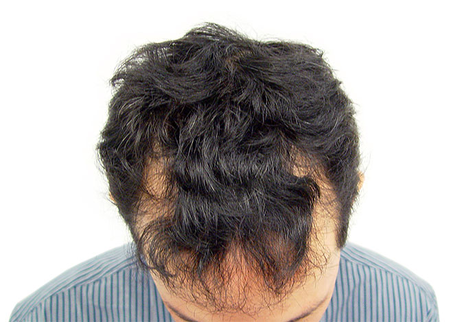 Before & After Photos | Dr. Shim Ching