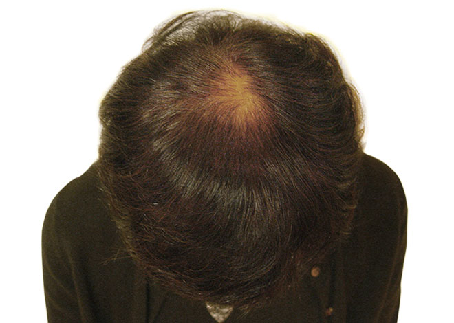 Before & After Photos | Dr. Shim Ching