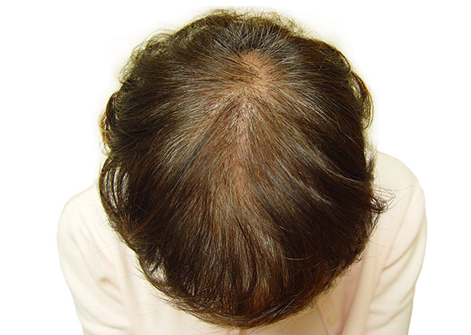 Before & After Photos | Dr. Shim Ching