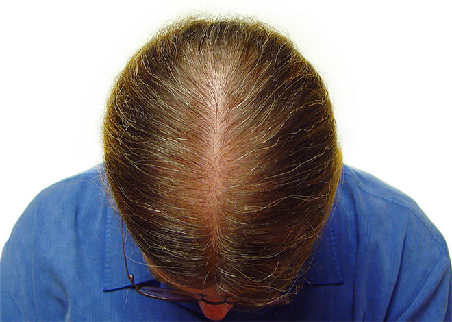 Before & After Photos | Dr. Shim Ching