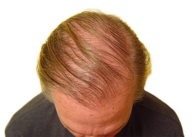 Before & After Photos | Dr. Shim Ching