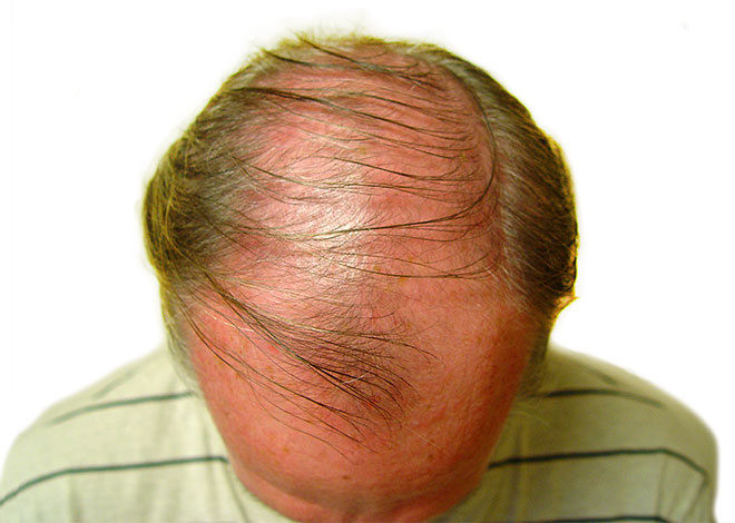 Before & After Photos | Dr. Shim Ching