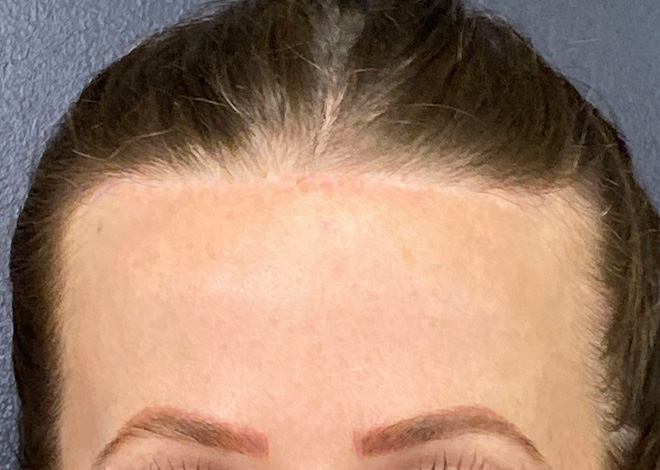 Before & After Photos | Dr. Shim Ching