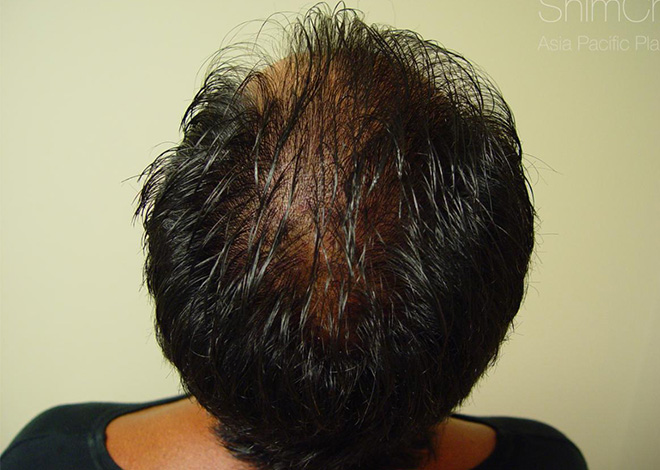 Before & After Photos | Dr. Shim Ching