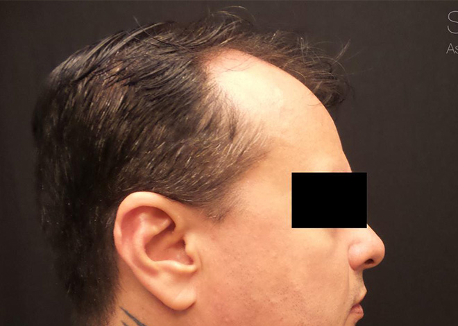 Before & After Photos | Dr. Shim Ching