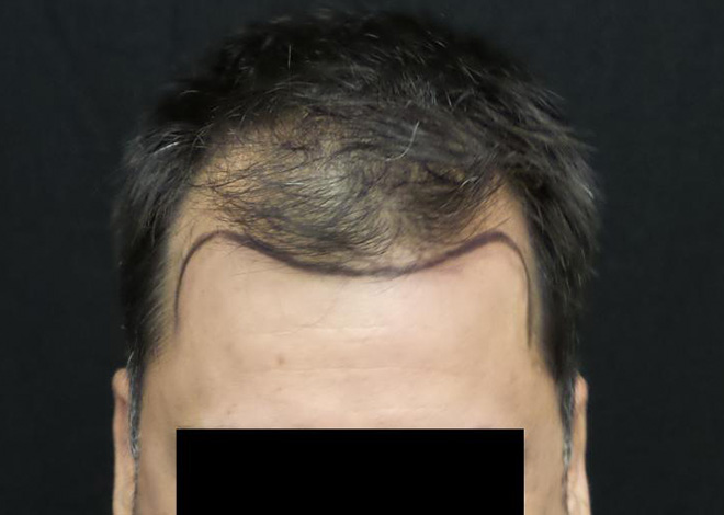 Before & After Photos | Dr. Shim Ching