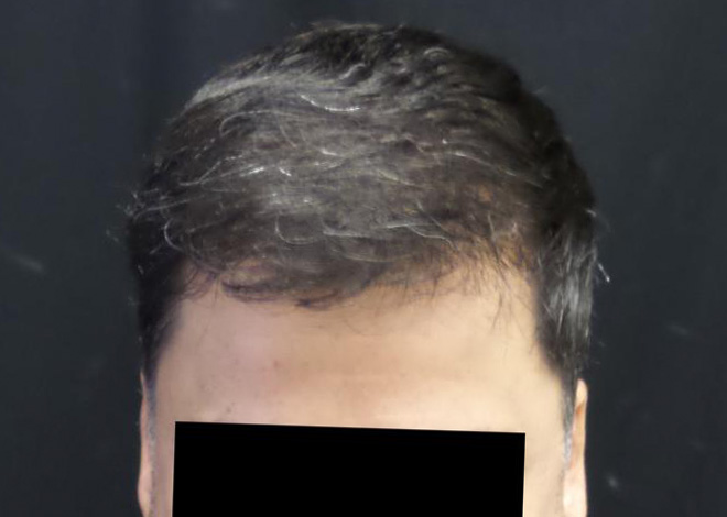 Before & After Photos | Dr. Shim Ching