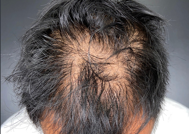 Before & After Photos | Dr. Shim Ching