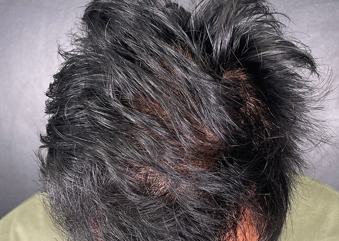 Before & After Photos | Dr. Shim Ching