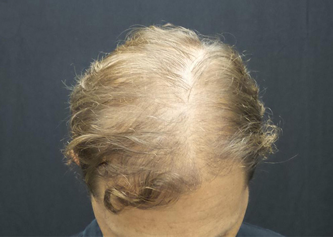 Before & After Photos | Dr. Shim Ching