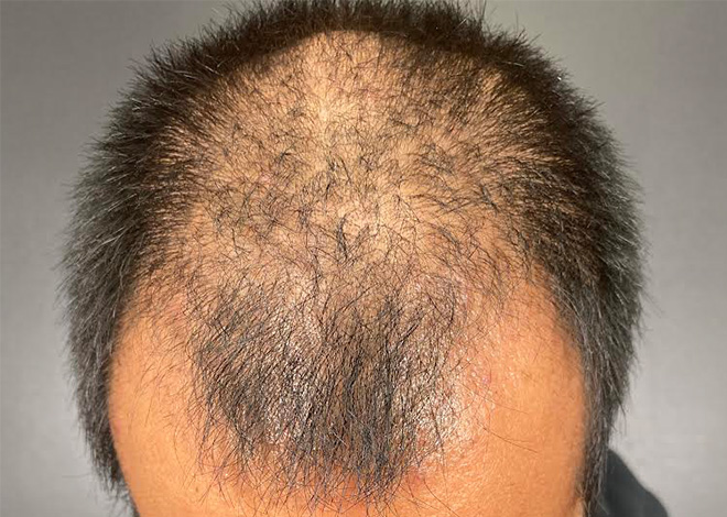 Before & After Photos | Dr. Shim Ching