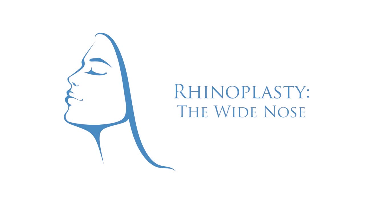 Wide Nose Rhinoplasty Philadelphia, PA | Nose Surgery by Dr. Anthony ...