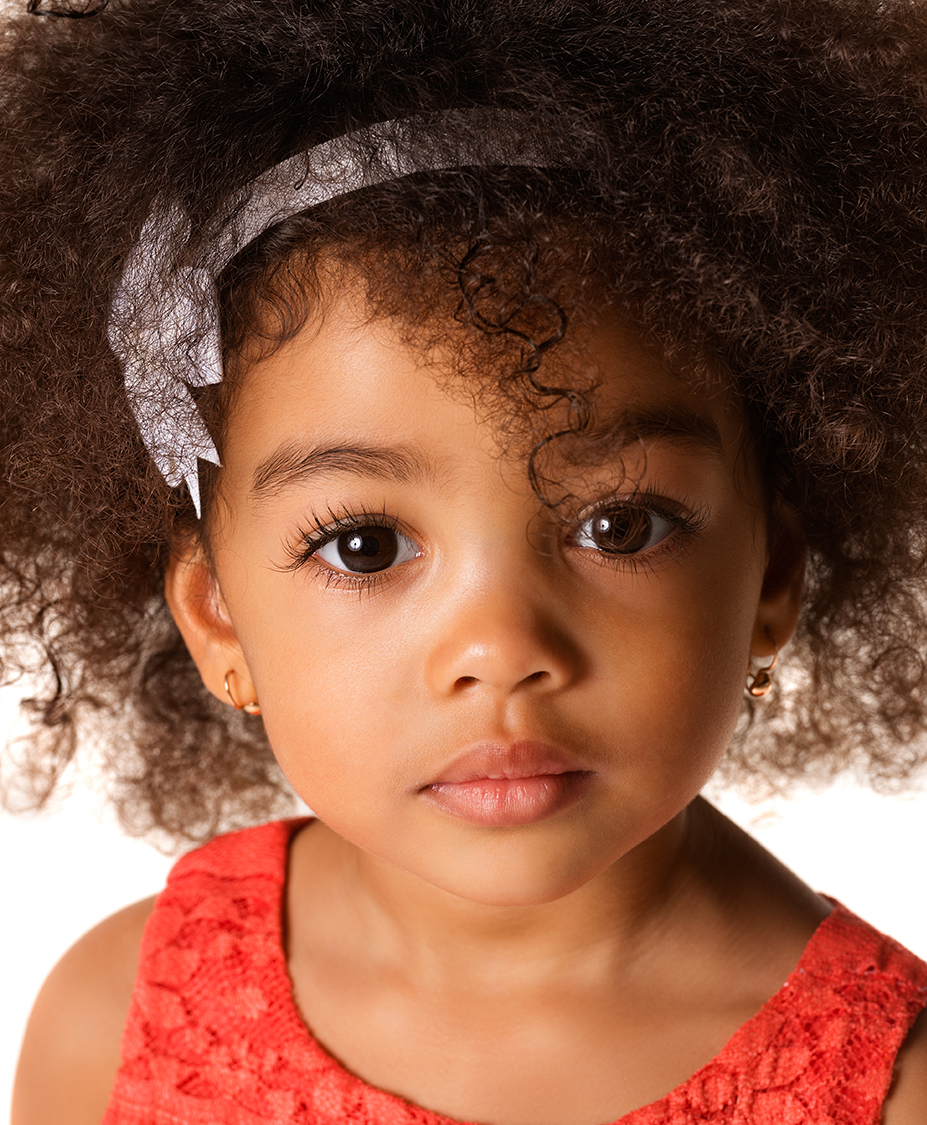 Scar Revision for Infants | Eisemann Plastic Surgery