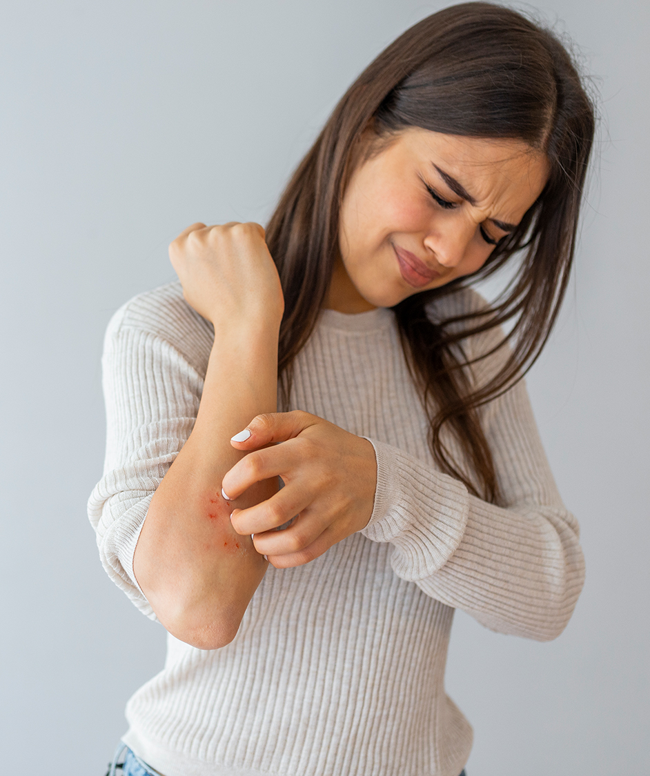 Intertrigo Phoenix | Best Intertrigo in Buckeye