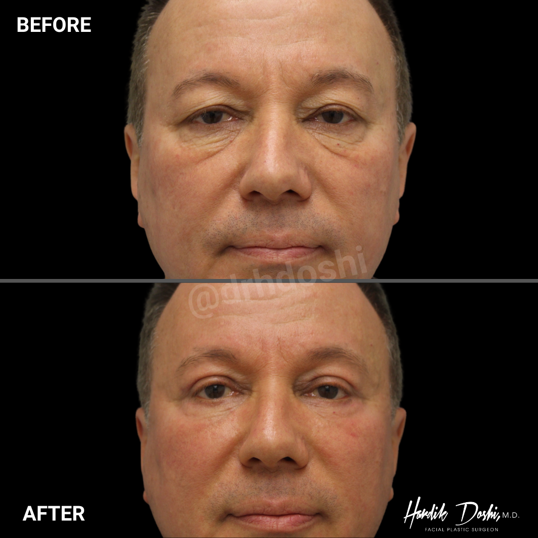 B&A Eyes Gallery | Dr. Hardik Doshi in Brooklyn