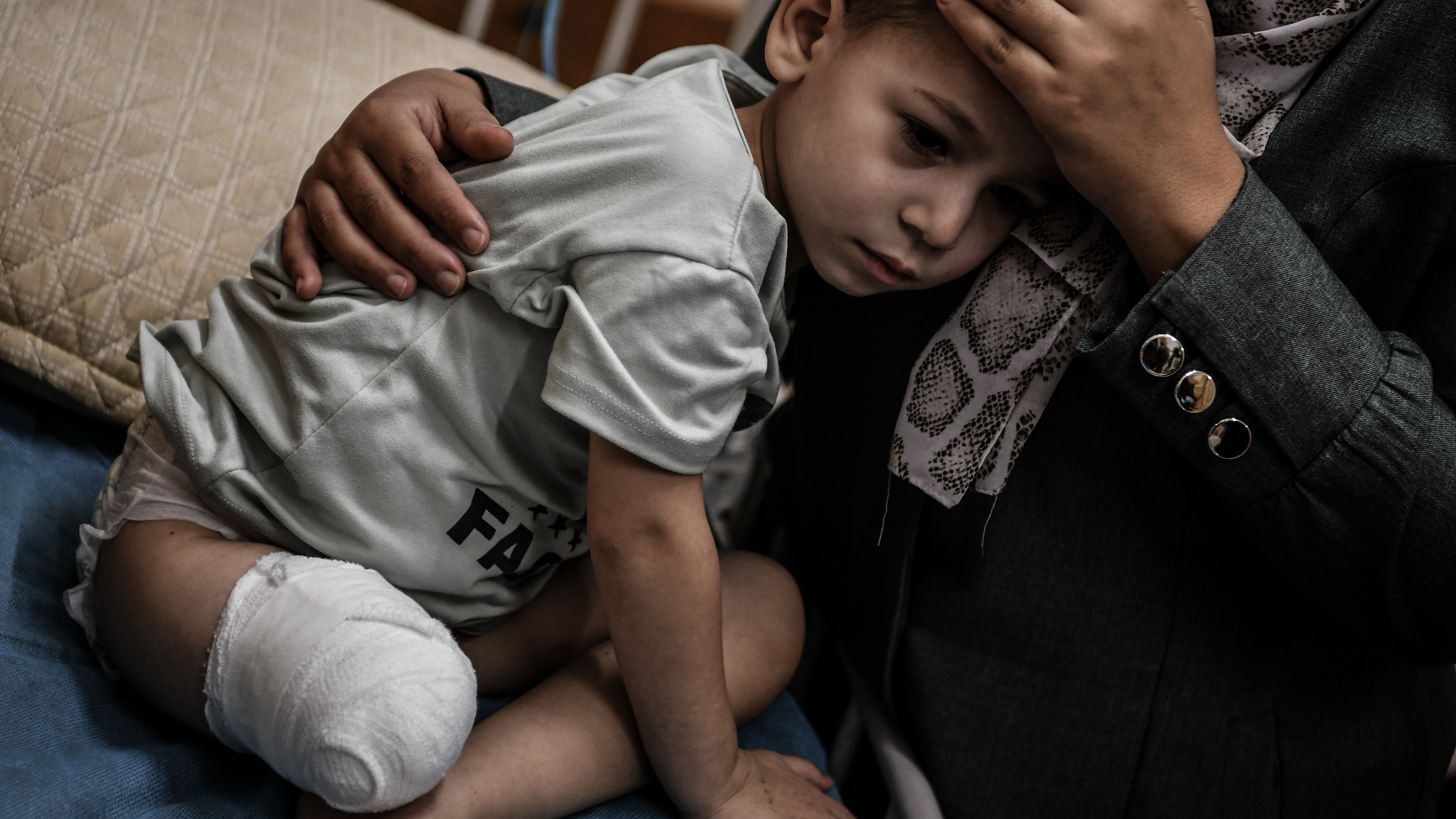 A Gaza, oltre 1.000 bambini hanno subito la perdita di un arto a causa ...