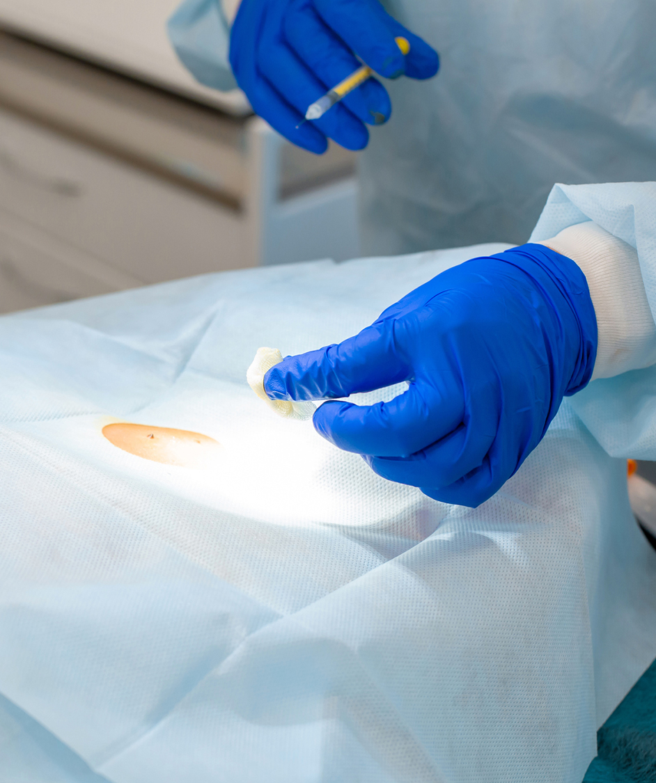 Thoracentesis & Paracentesis Beverly Hills