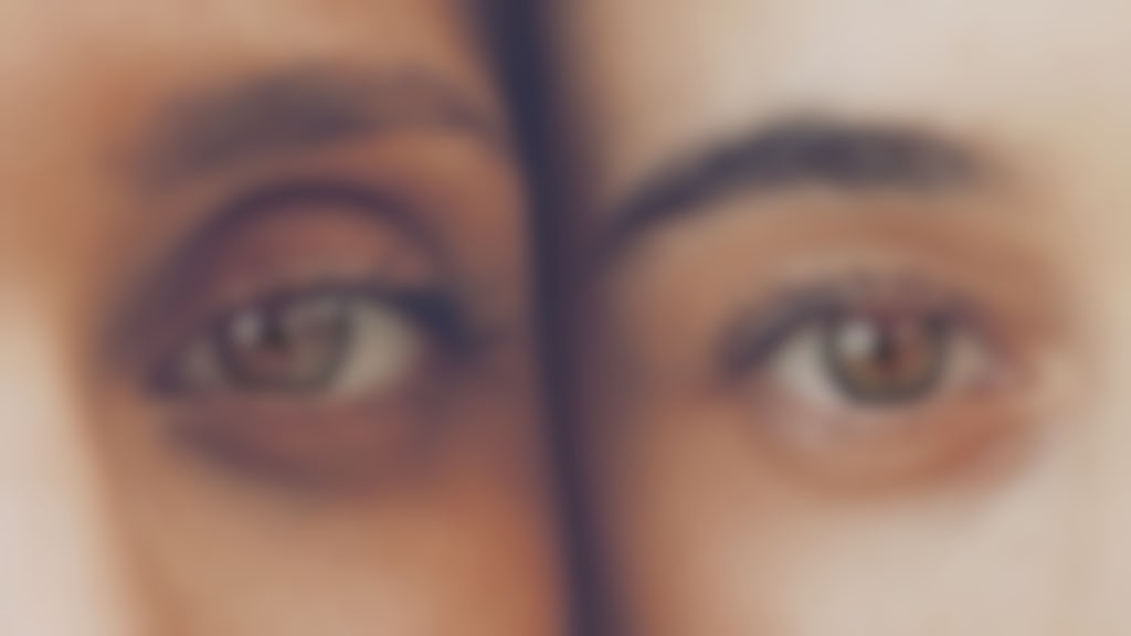 Dark Circles Under Eyes Causes And Treatments MTHK dark-circles-under-eyes-causes-and-treatments-mthk