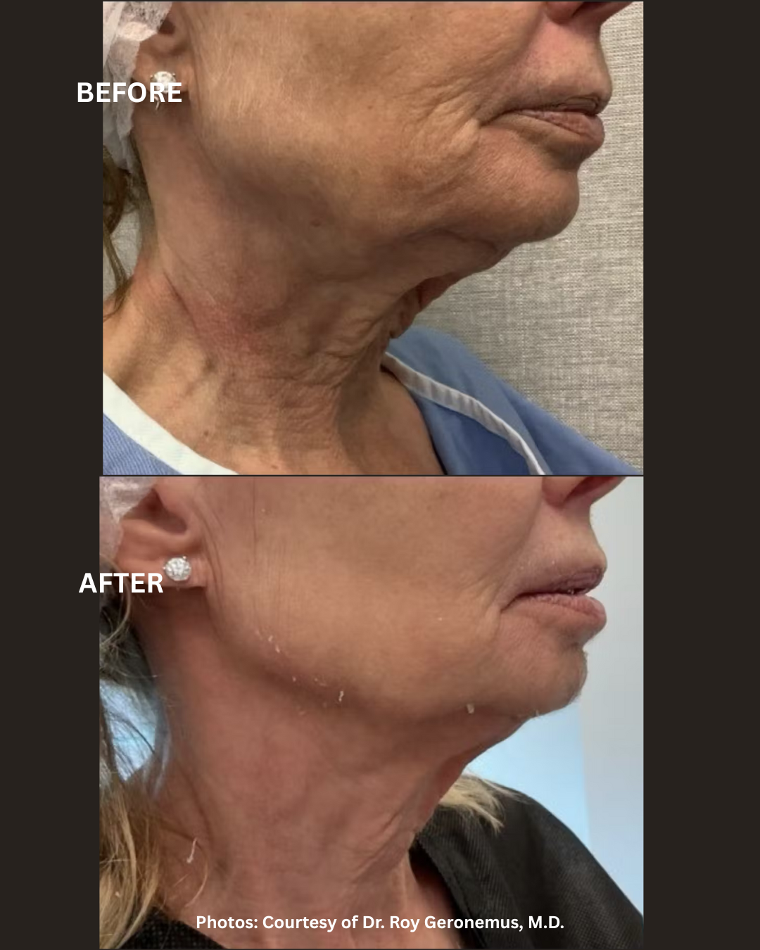 AVAVA | Hazen Plastic Surgery and Medspa