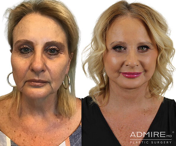 Plastic Surgery Scottsdale and Phoenix, AZ | AdmireMD Plastic Surgery