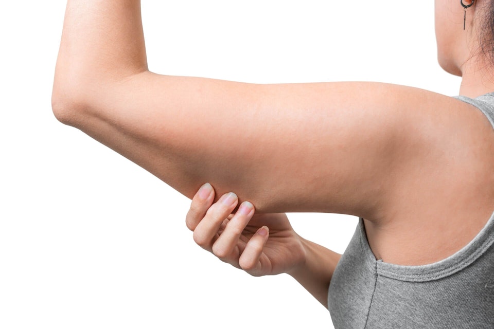 Arm Liposuction Redefined | AirSculpt®