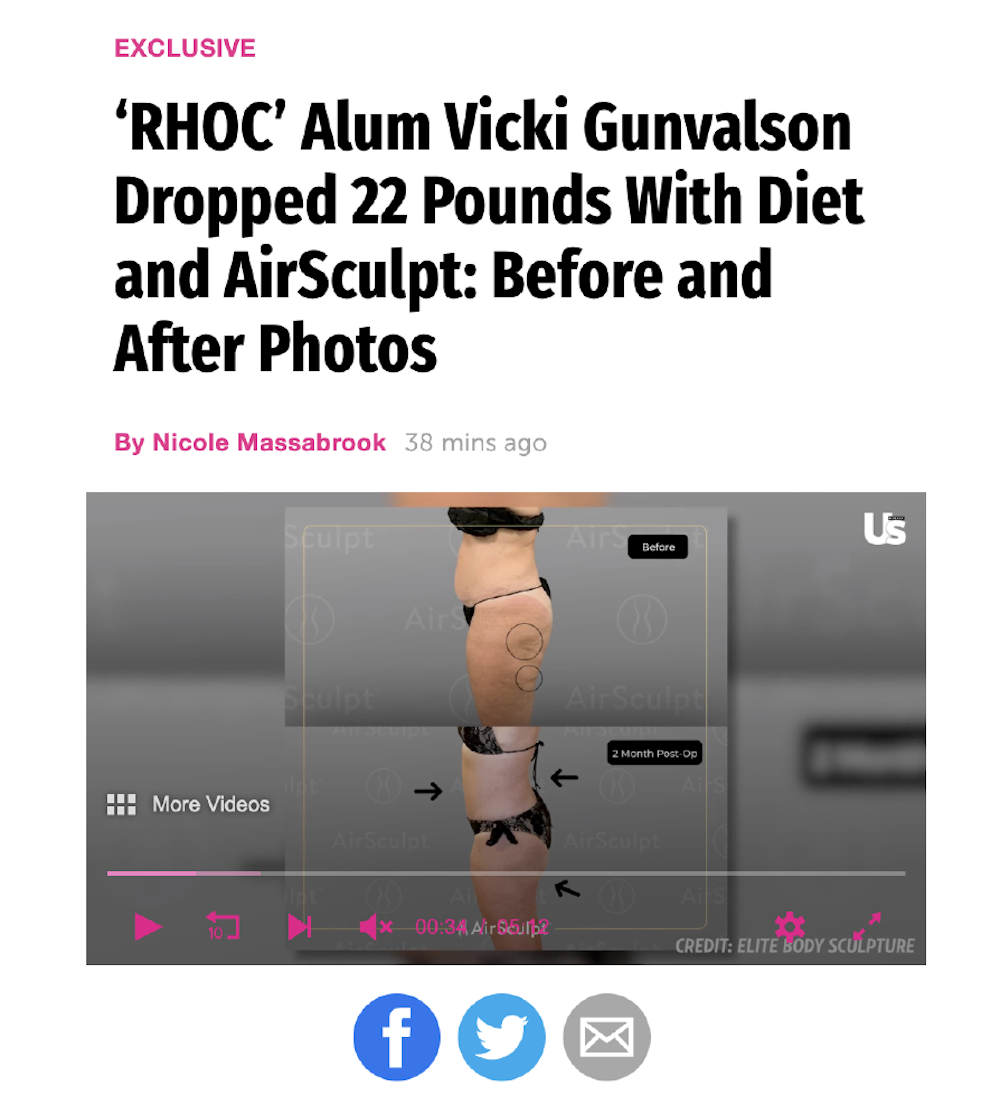 ‘RHOC’ Alum Vicki Gunvalson Dropped 22 Pounds With Diet and AirSculpt ...