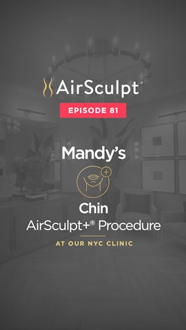 Chin Liposuction Reinvented | AirSculpt®