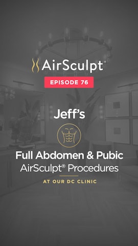 Next-Gen Mons Pubis Reduction | AirSculpt® Pubic Fat Removal