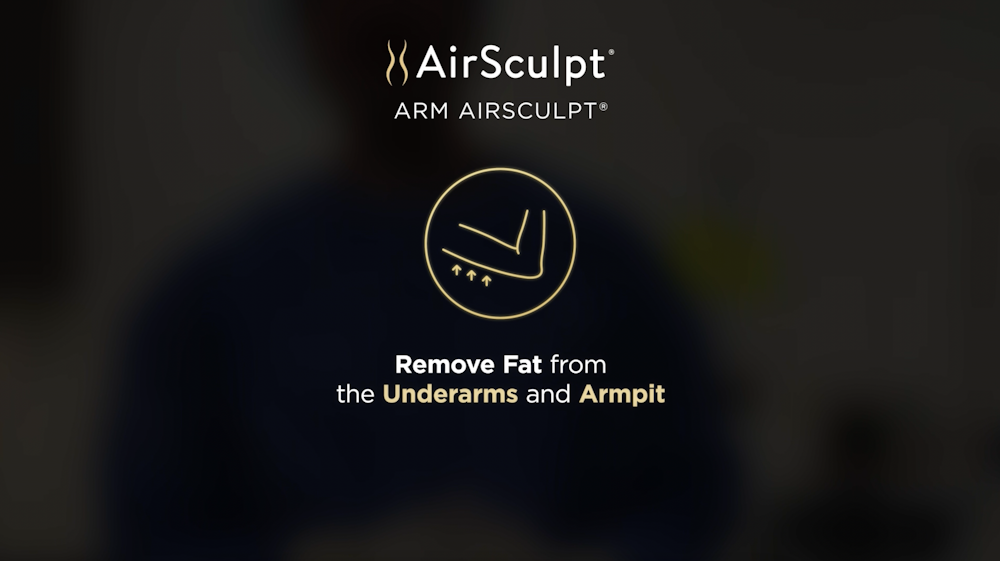 Arm AirSculpt | Elite Body Sculpture Videos