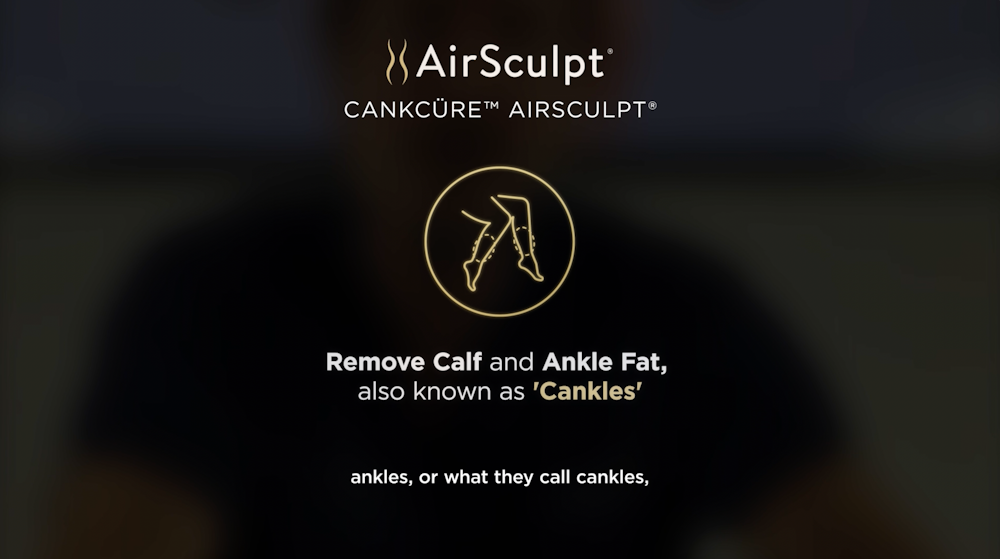AirSculpt® CankCüre™ | Elite Body Sculpture Videos