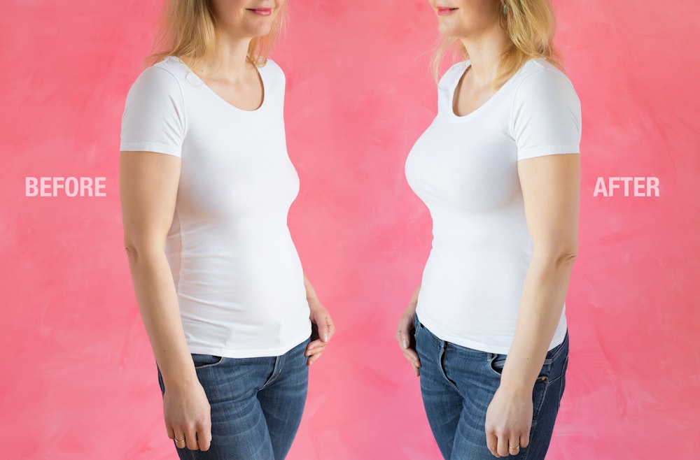 Airsculpt Breast Before And After