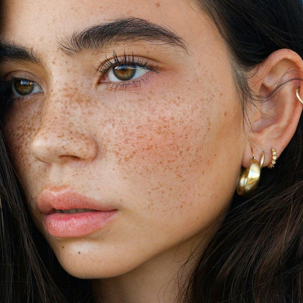 Freckles: What You Need To Know Before Switching From Insta Filter To ...