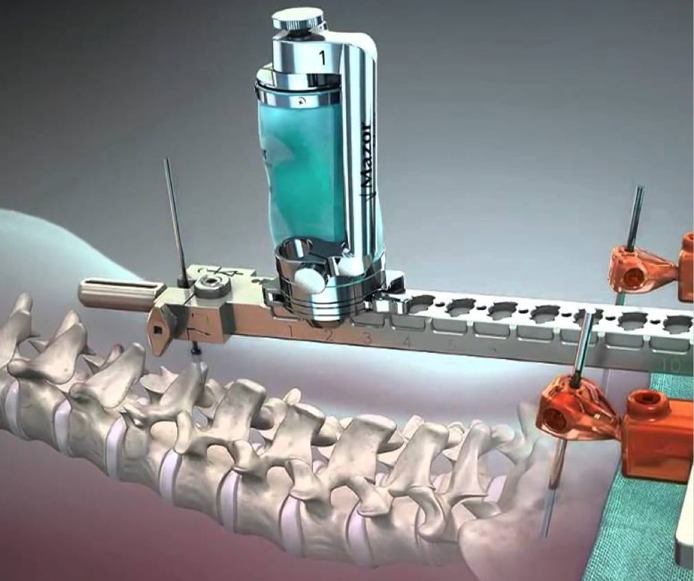 Spine Surgery New Jersey | Orthopedic Surgeon in NJ | Dr. Joshua Rovner