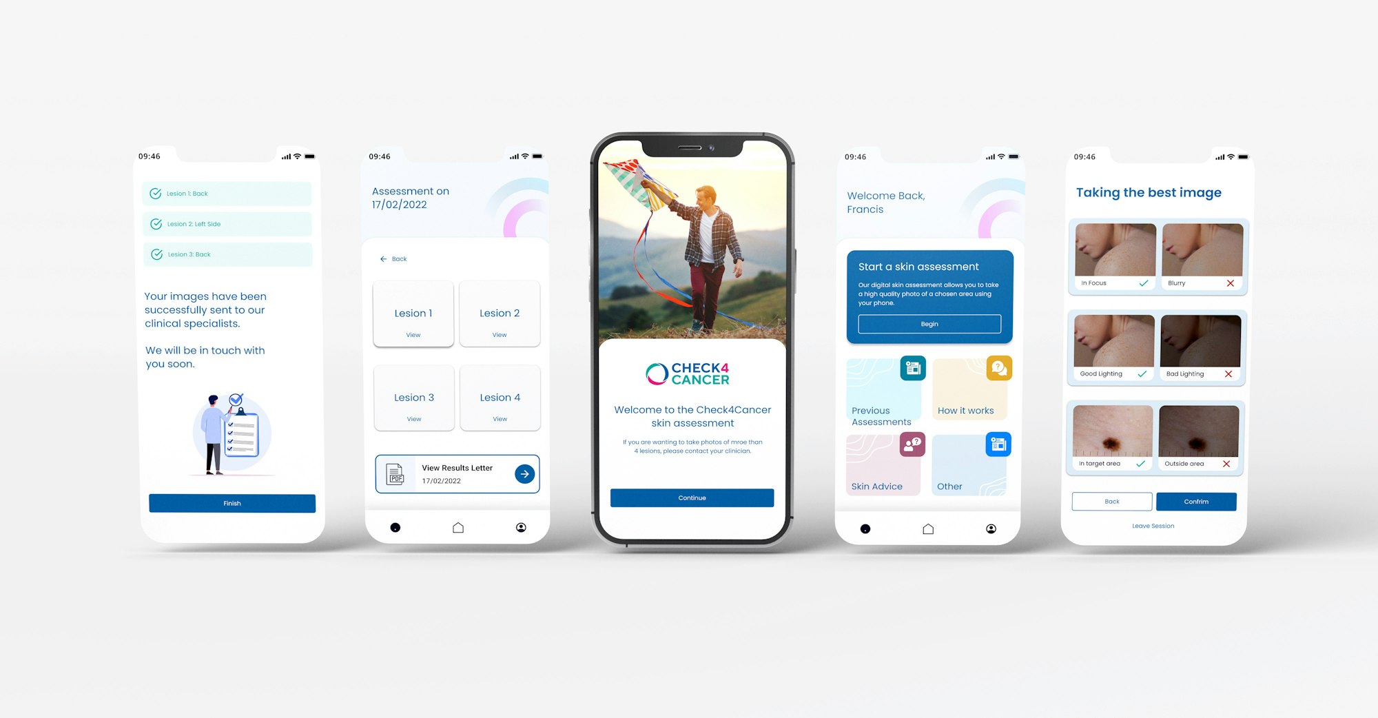 Check4Cancer - Vivolution.