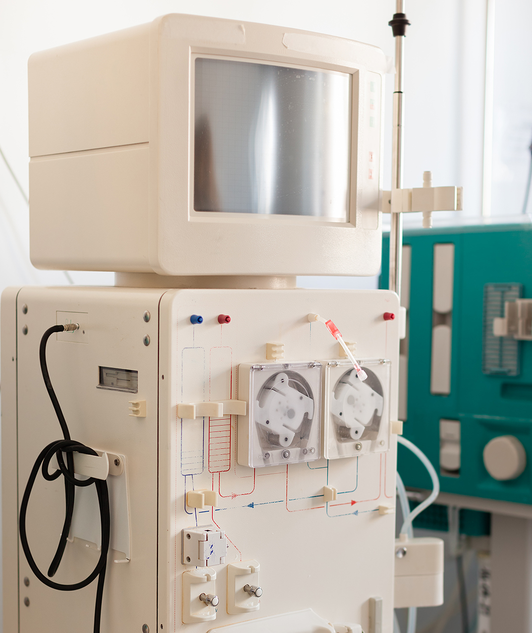 Dialysis Access Services | Advanced Surgical Technology