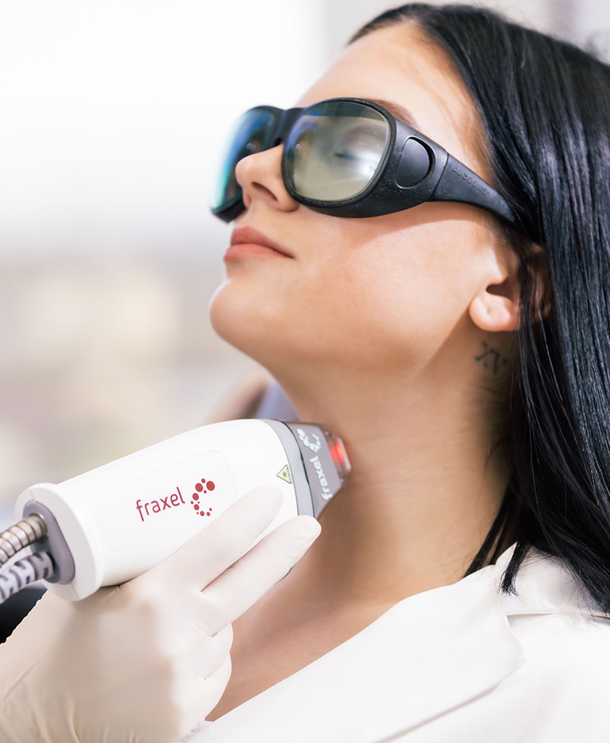 Fraxel Laser Treatment Santa Monica | Laser Skin Resurfacing Santa Monica