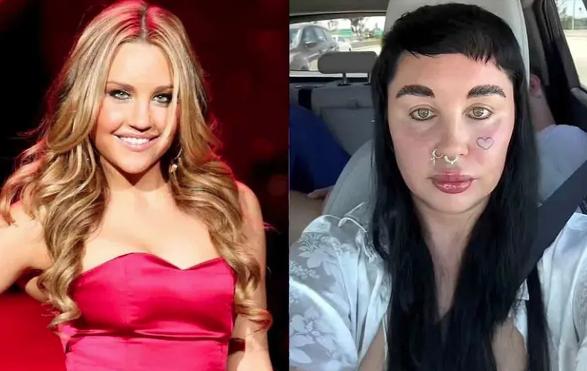 Amanda Bynes sobre perda de peso após depressão: “Fundo do poço”