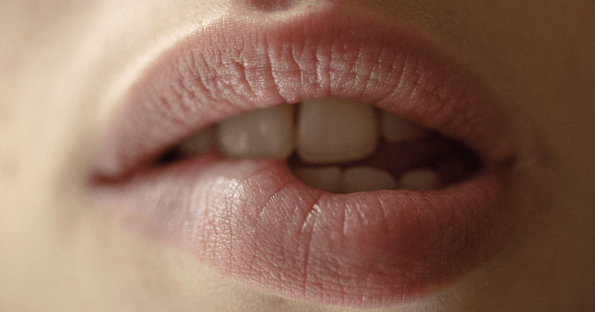 Todo lo que tienes que saber sobre los fillers antes de aplicártelos