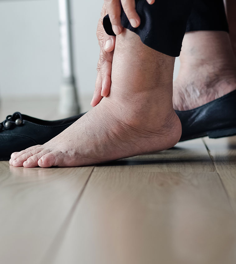 Diabetic Ulcer Treatment in San Francisco, CA | 8th Element