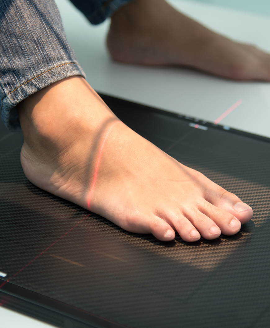 Corrective Foot Surgery Newport Beach | Rancho Santa Margarita