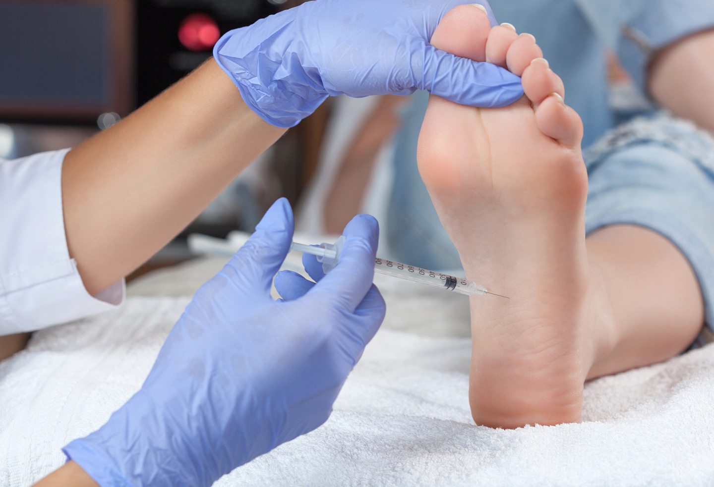 Ganglion Cyst Removal Toe