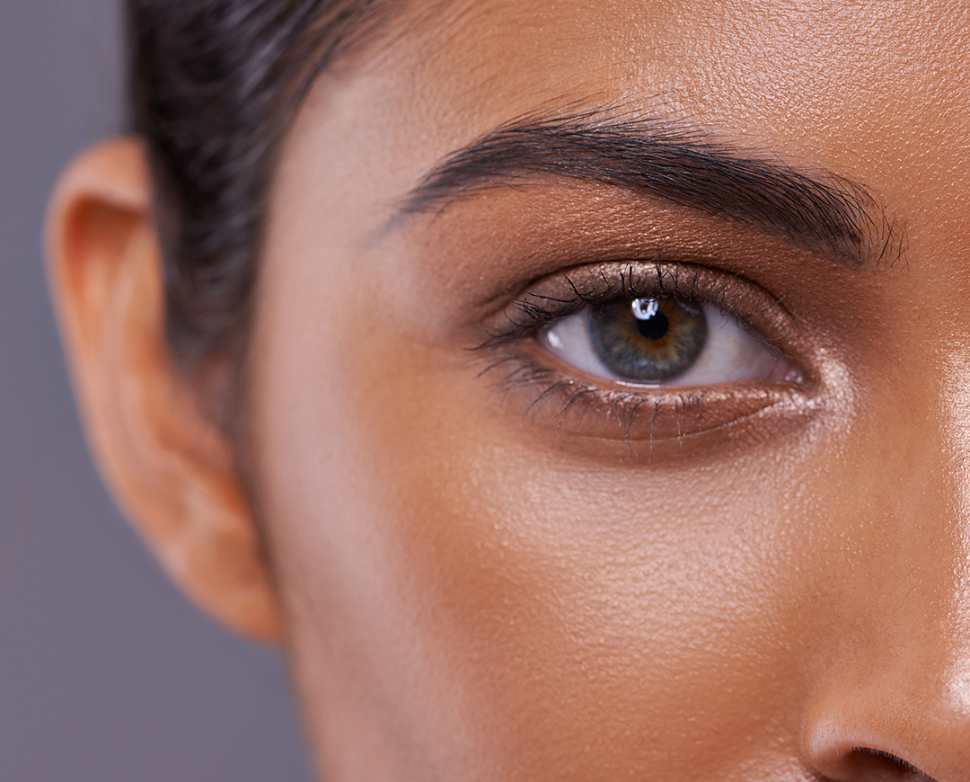 How Is Entropion Treated