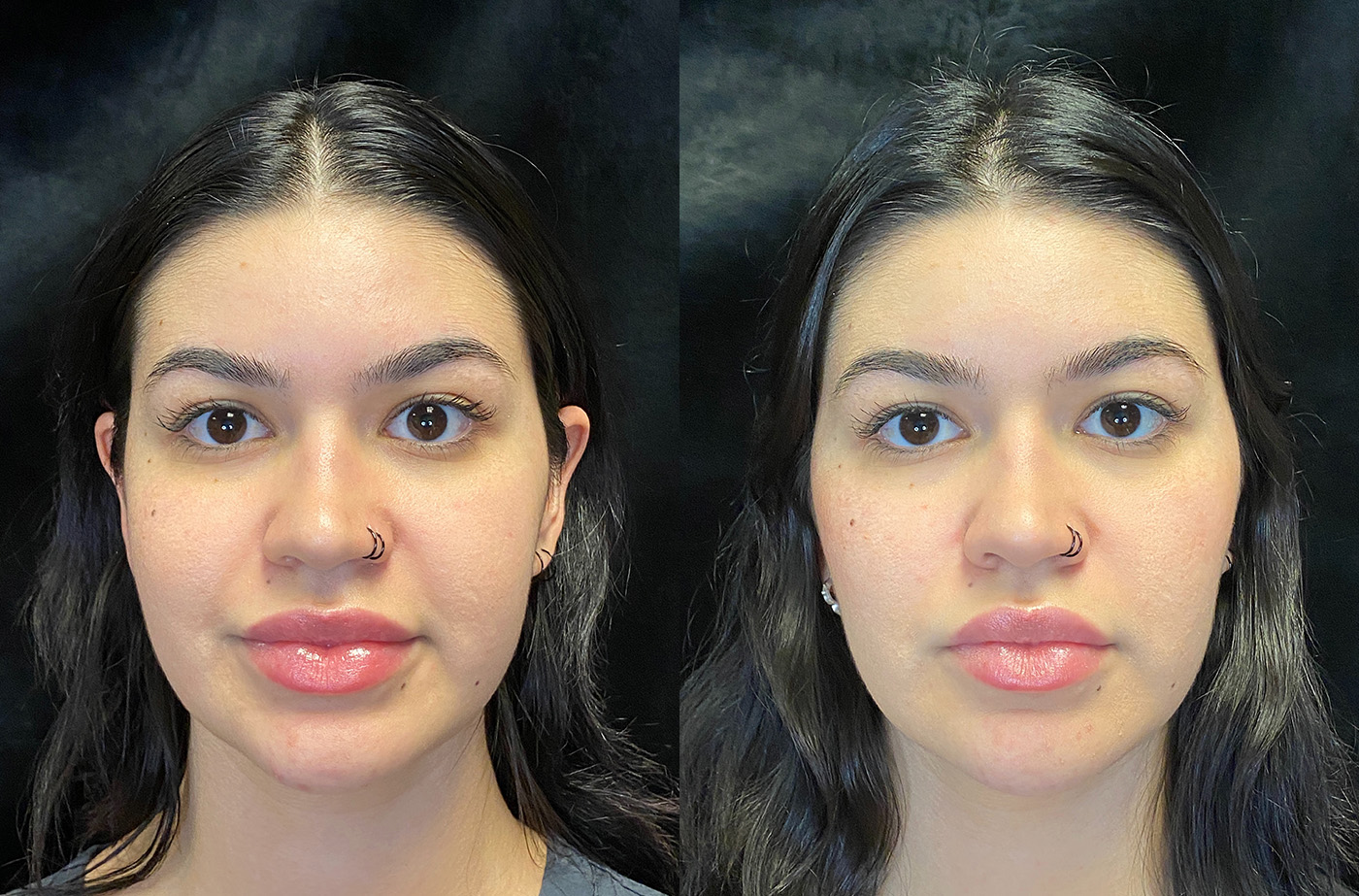 Patient 147418315 | Gallery | Modern Women's Health
