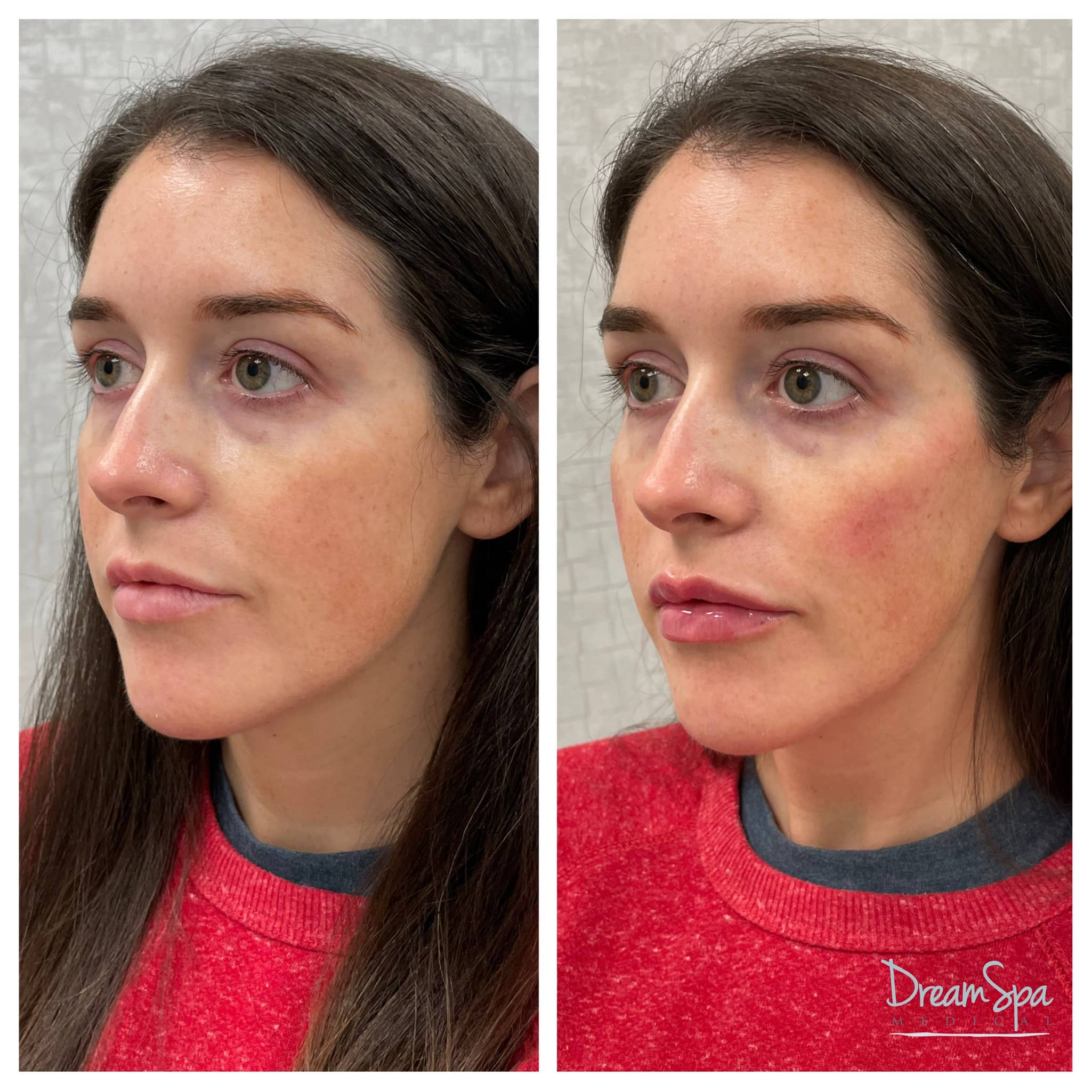 Contouring Before And After