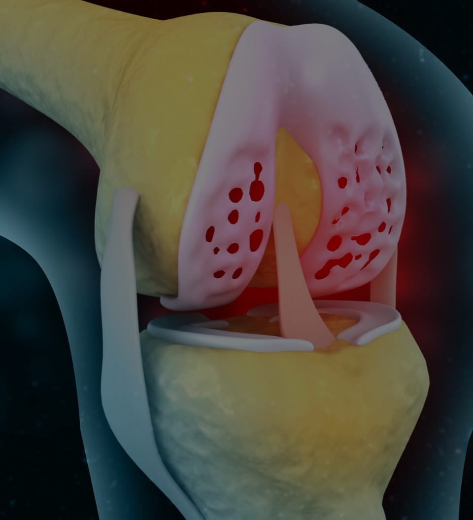 Knee and Hip Surgery Specialists | Nanoknee